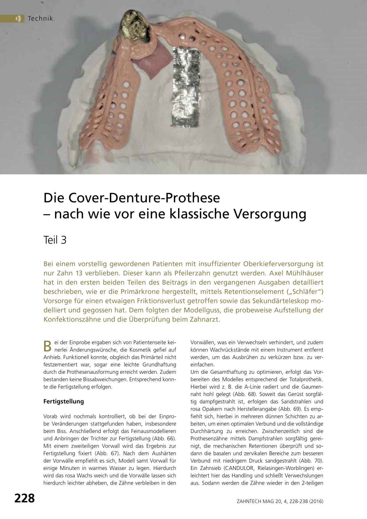 FB | Die Cover-Denture-Prothese Teil 3 › Komet Magazin