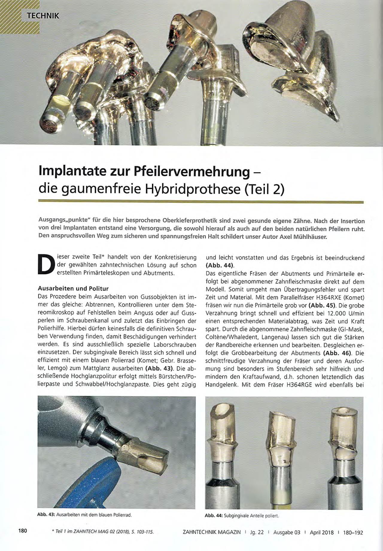 FB | Implantate zur Pfeilervermehrung - die gaumenfreie Hybridprothese ...
